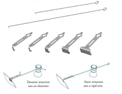 Restraint & Retraction - Uno Life Science
